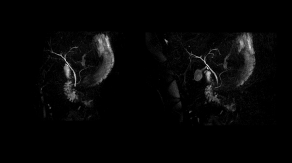 МР-томограф Signa Explorer 1.5T GE Healthcare купить в Москве, цена на ...